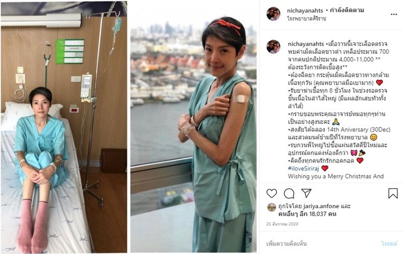 เครียดแต่ยิ้มกว้าง นิ้ง เผยภาพตอนไม่รู้สึกตัวที่ICU แห่ให้กำลังใจ | Khaosod | LINE TODAY