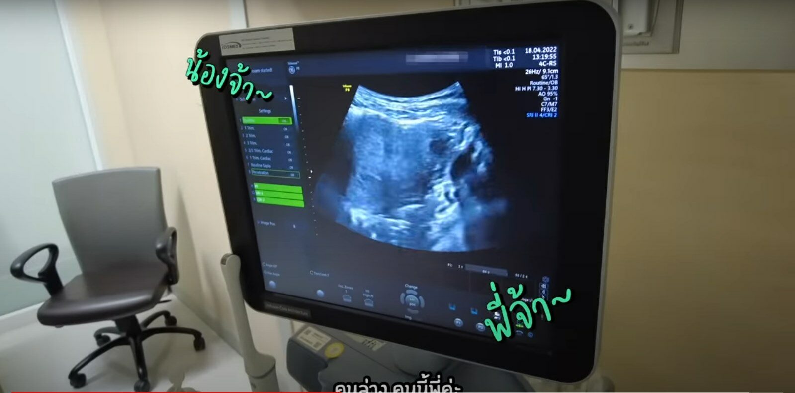 บีม เปิดใจ ภรรยาท้องลูกแฝดรอบ2 ท้องธรรมชาติเปล่า? อวดโฉมภาพอัลตร้าซาวด์