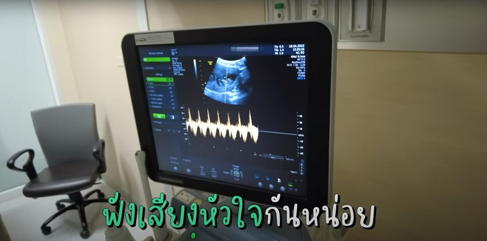 บีม เปิดใจ ภรรยาท้องลูกแฝดรอบ2 ท้องธรรมชาติเปล่า? อวดโฉมภาพอัลตร้าซาวด์