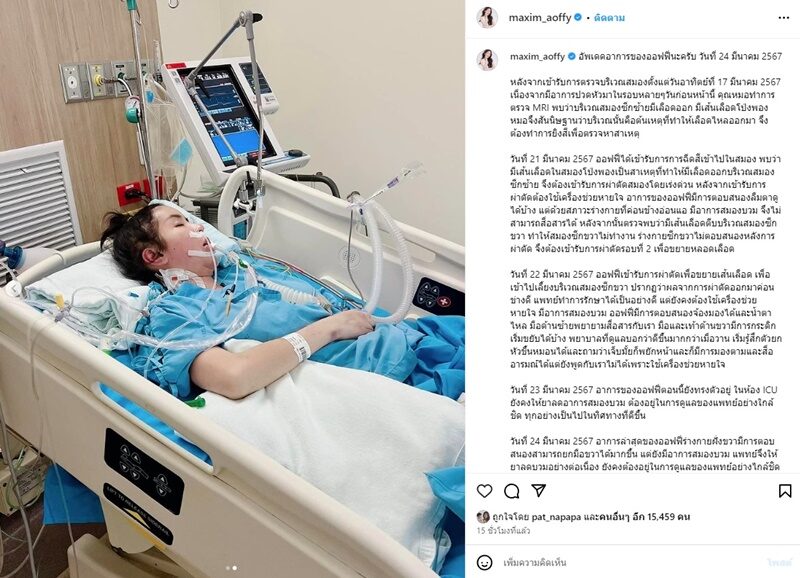 ผ่าตัดสมอง ออฟฟี่ แม็กซิม เผยสาเหตุ-อาการล่าสุดสมองยังบวม ยังอยู่ที่ ICU - ข่าวสด